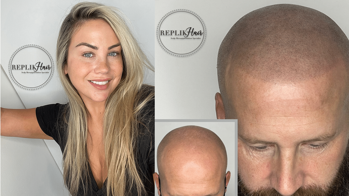 Replik Hair - Pioneering Scalp Micropigmentation Specialists In The UK ...